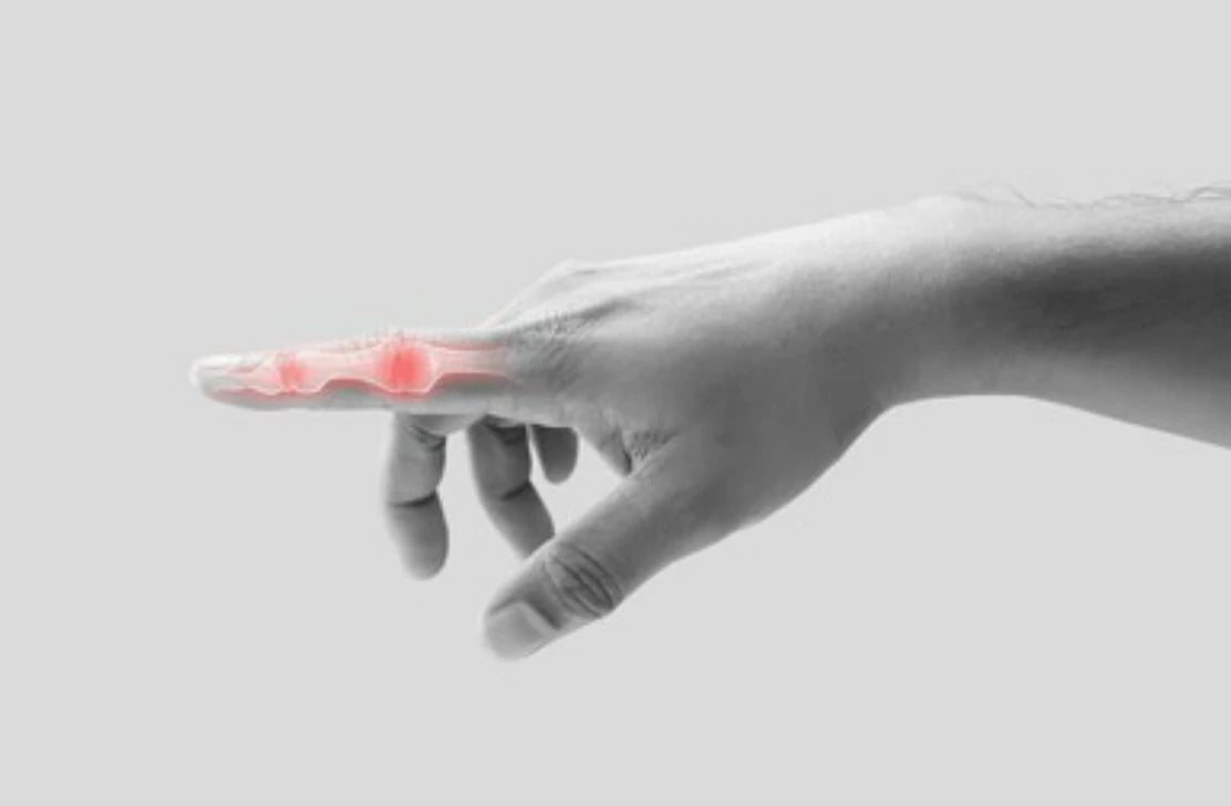 Exercises to Help Alleviate Trigger Finger and Restore Mobility: Exper ...