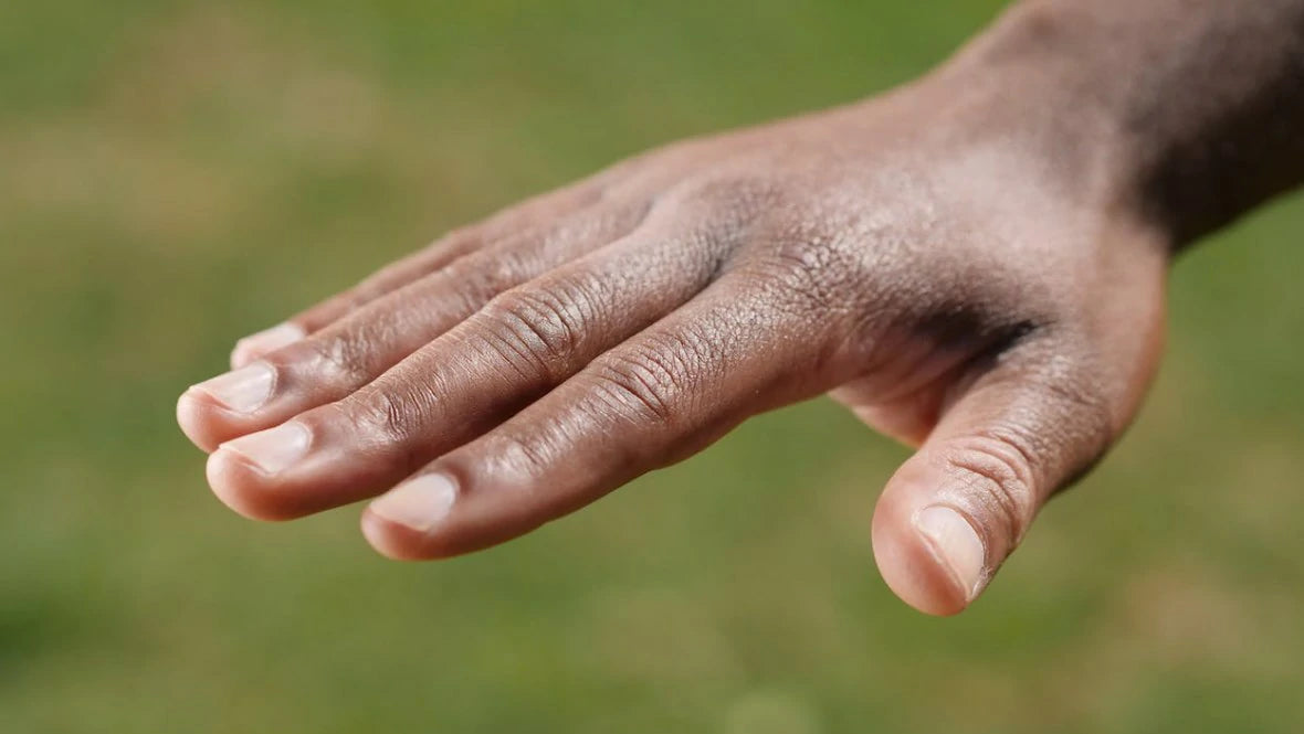 Finger Surgery Recovery Exercises – FitBeast